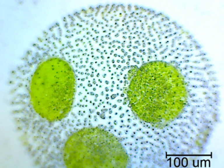 Transmission measurement of Volvox by using microscopic ...